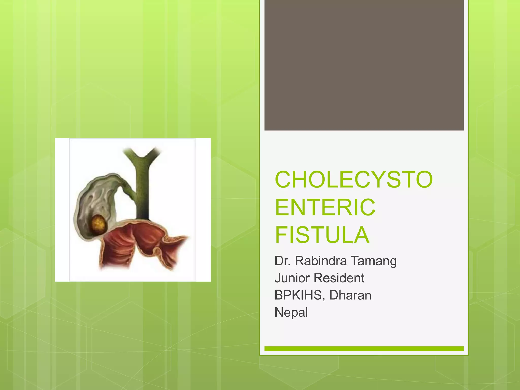 Cholecystogastric fistula | PPTX