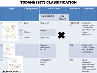Choledocal cyst | PPTX