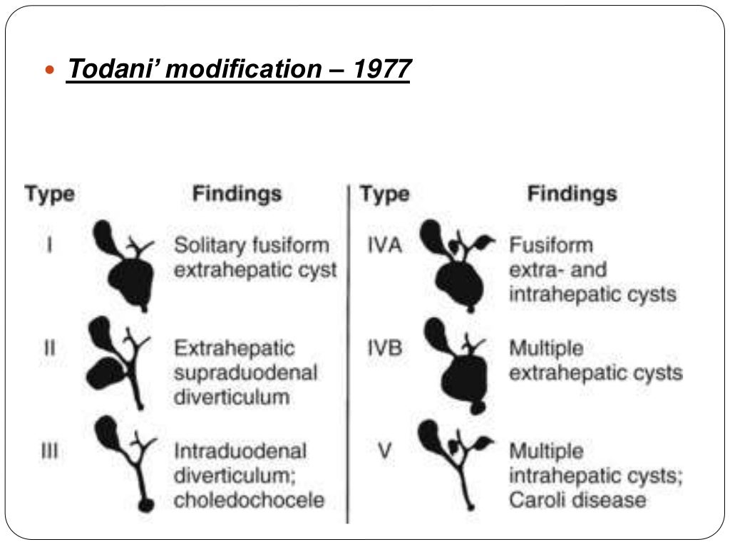 Choledochal cyst, biliary Cyst