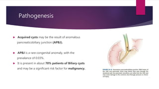 Choledochal cyst | PPTX