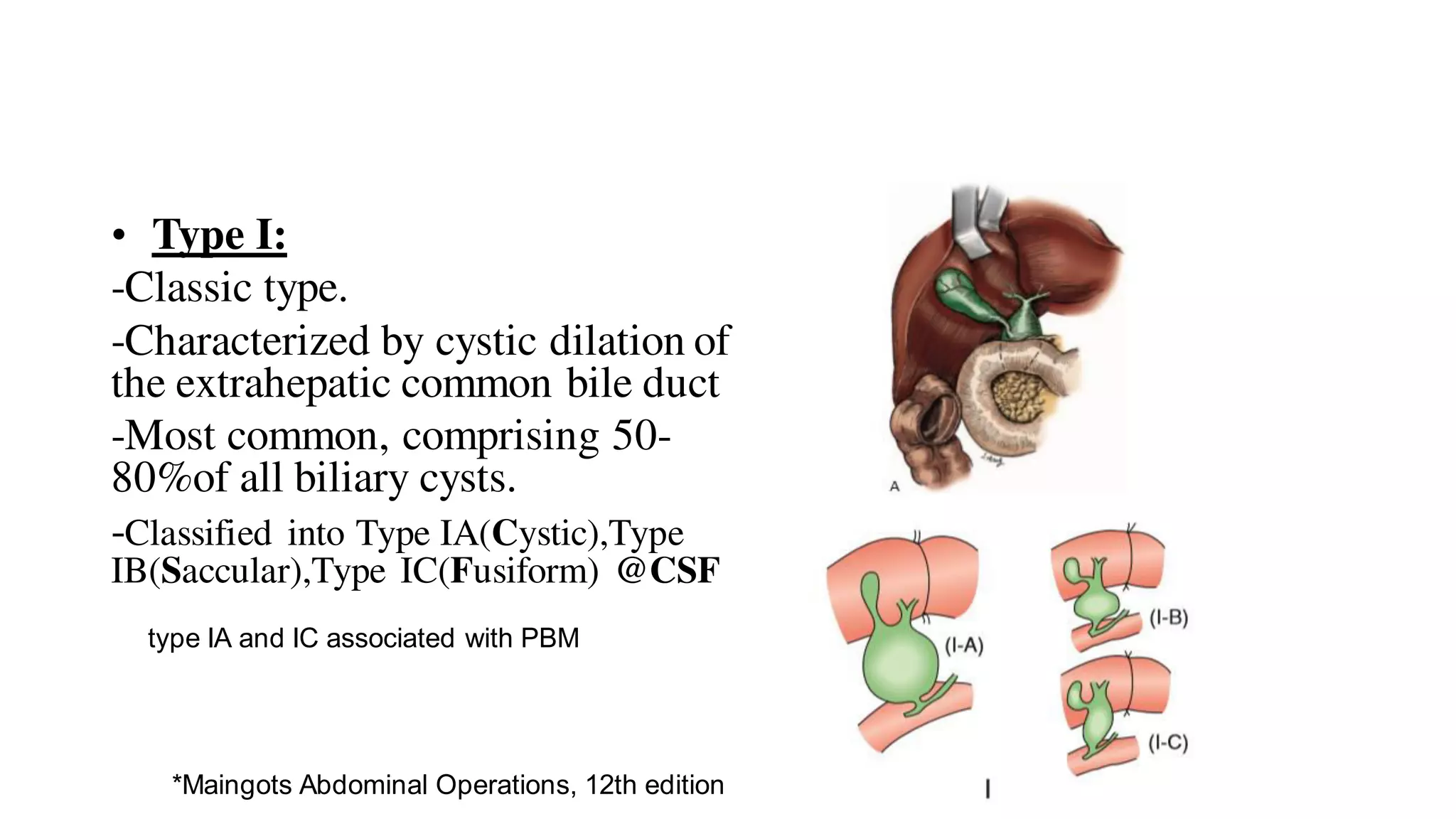 Choledochal cyst | PDF