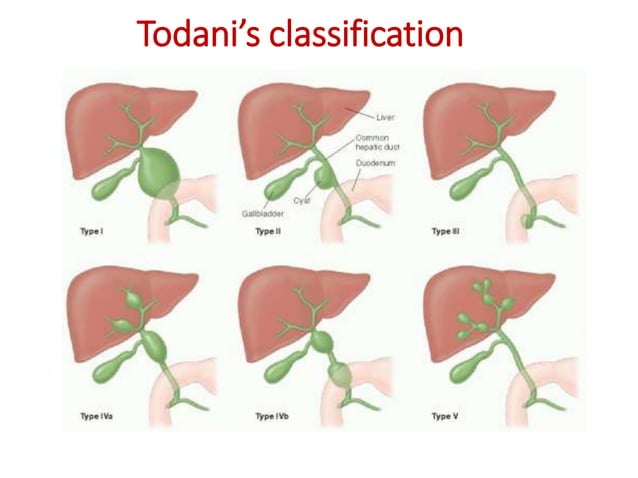 Choledochal cyst & Biliary atresia.pptx