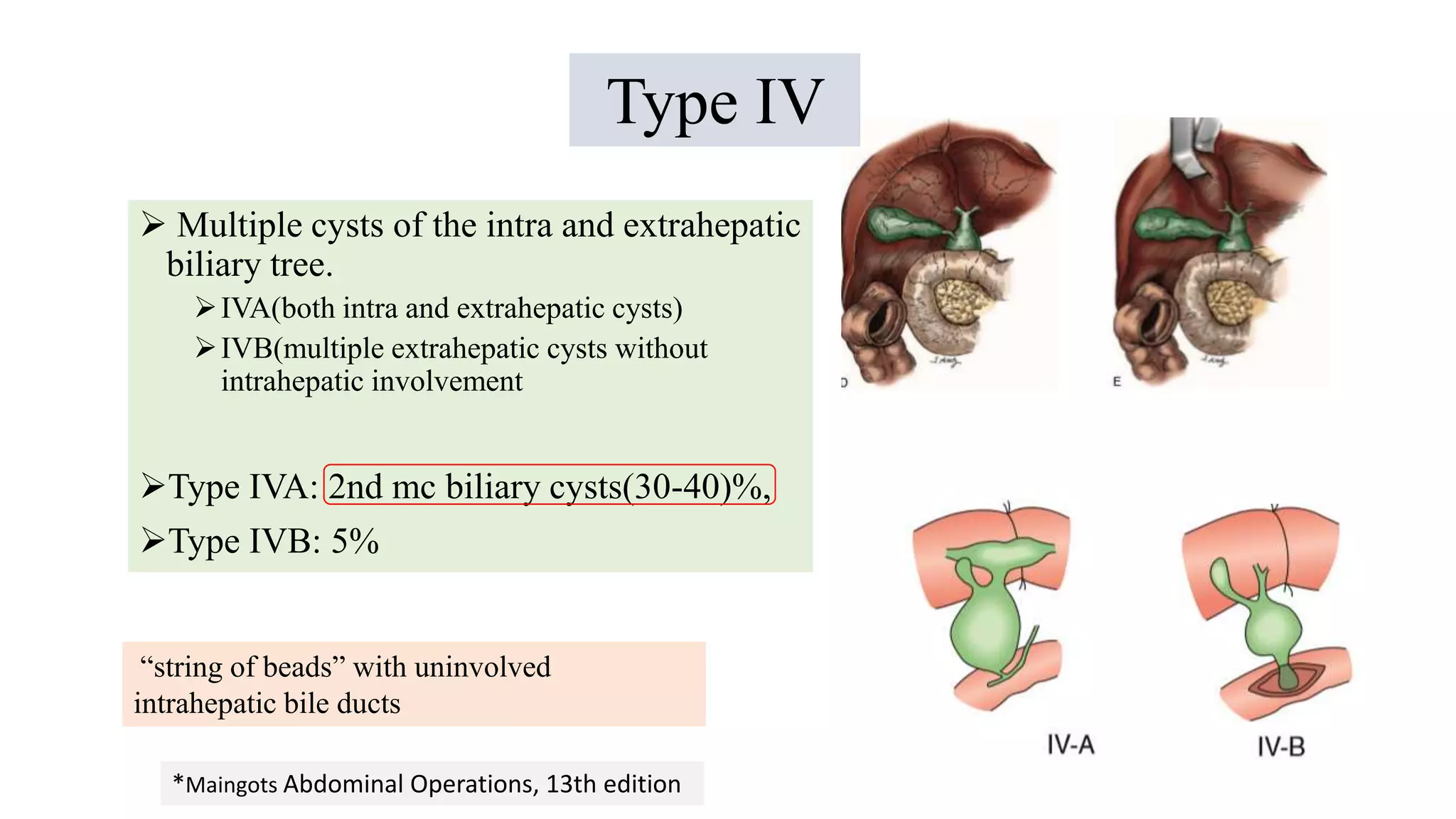 Choledochal cyst | PPTX