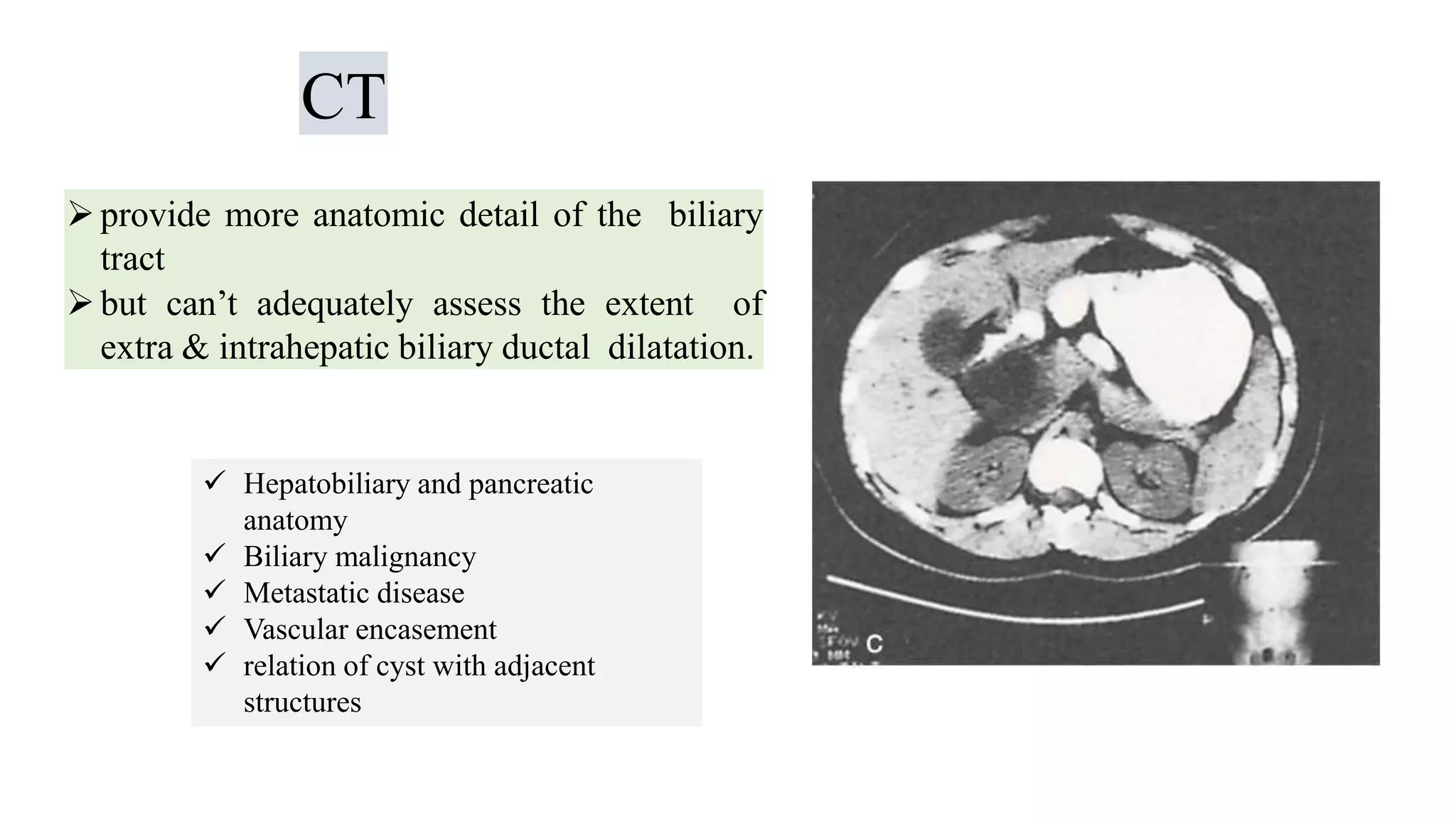 Choledochal cyst | PPTX | Digestive Disorders | Diseases and Conditions
