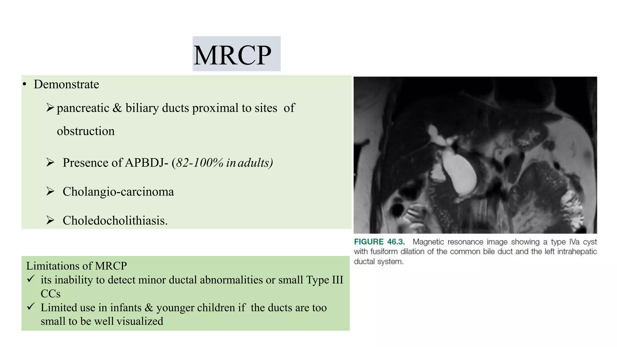 Choledochal cyst | PPTX
