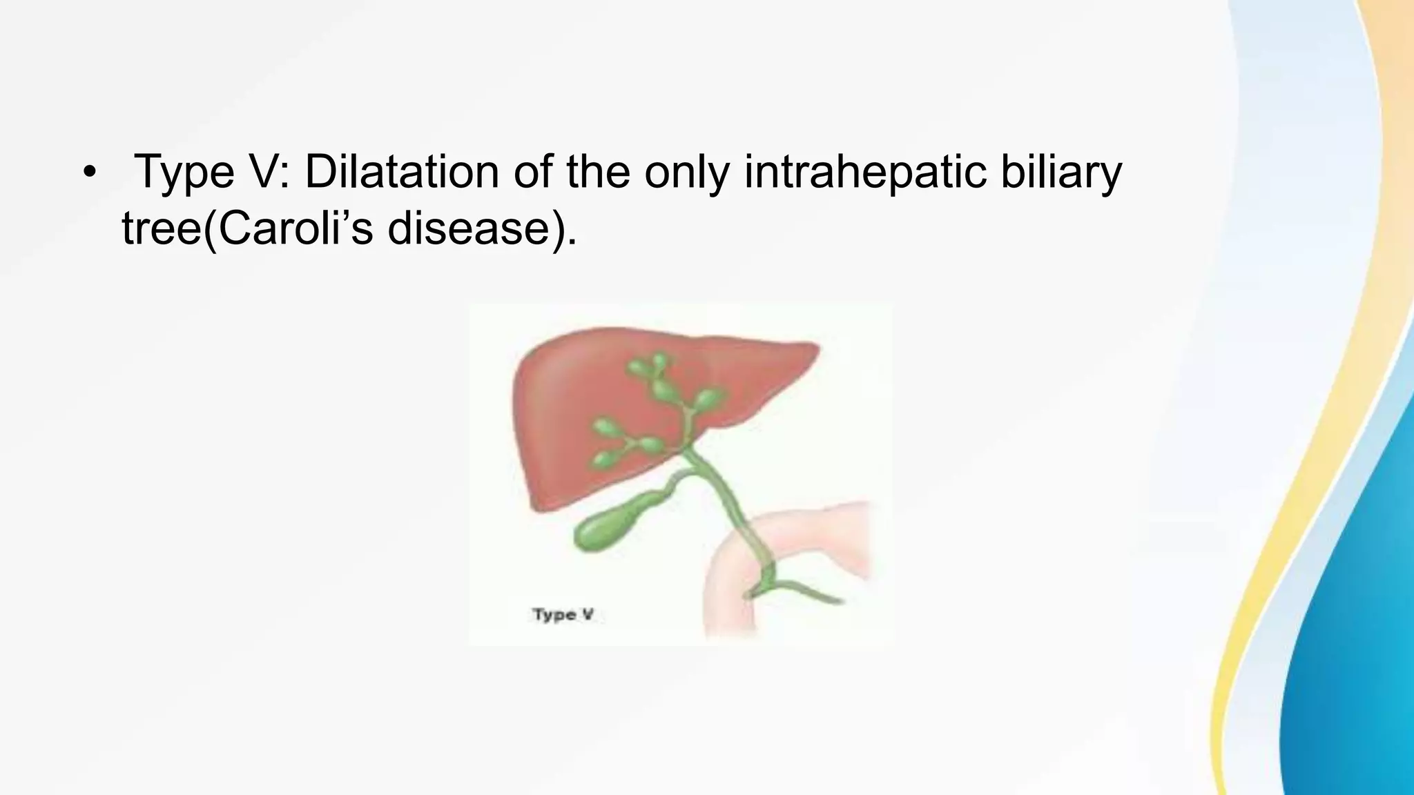 Choledochal cyst | PPTX