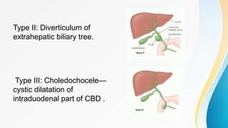 Choledochal cyst | PPTX