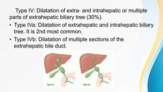 Choledochal cyst | PPTX