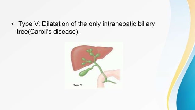 Choledochal cyst | PPTX | Digestive Disorders | Diseases and Conditions