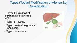 Choledochal cyst | PPT