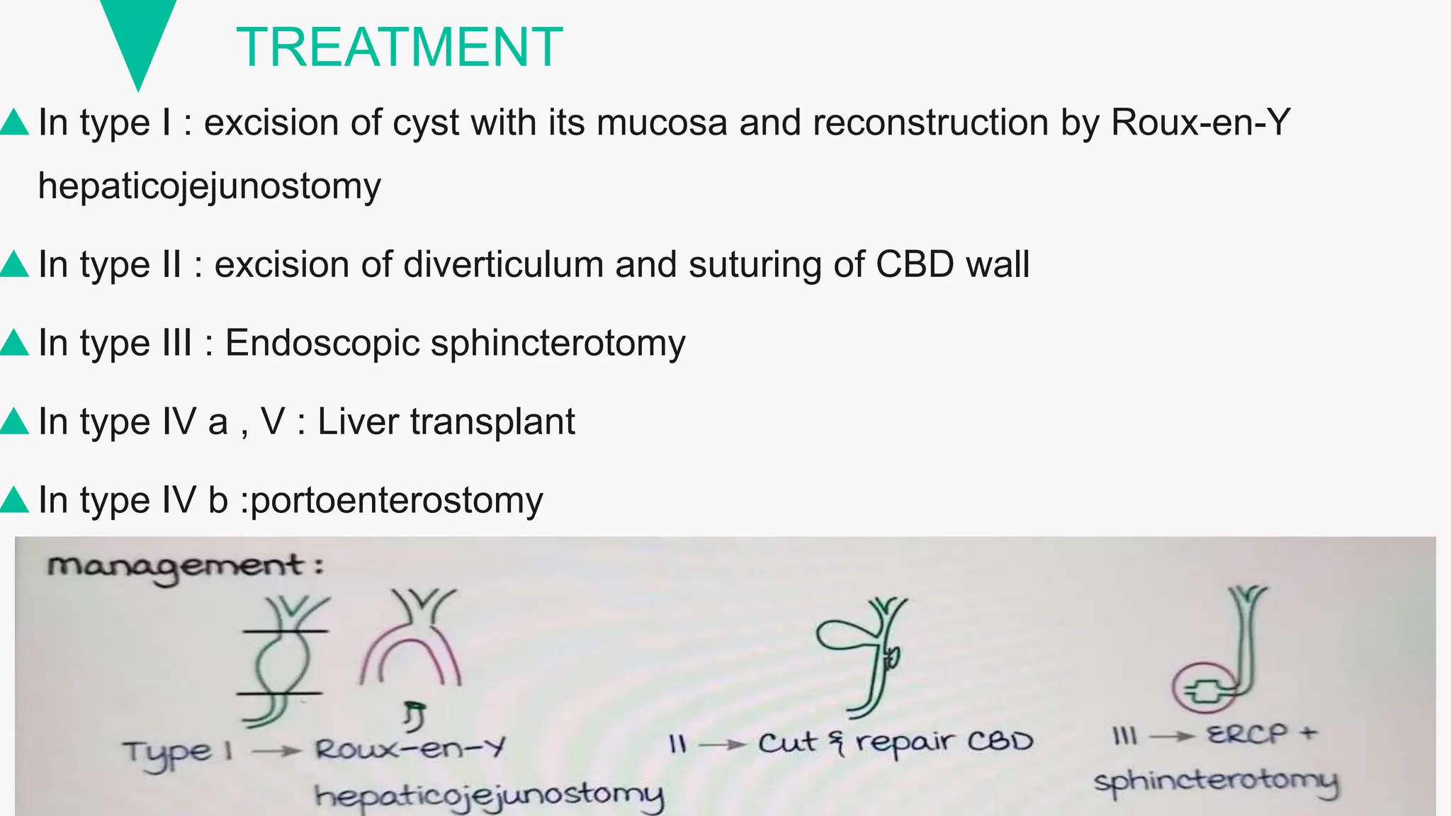 CHOLEDOCHAL CYSTS. Description done pptx | PPTX