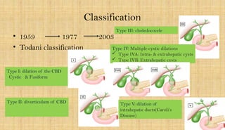 Choledochal Cysts pediatric surgery prese.pptx