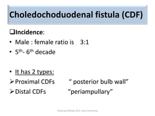 Choledochoduodenal fistulas | PPT