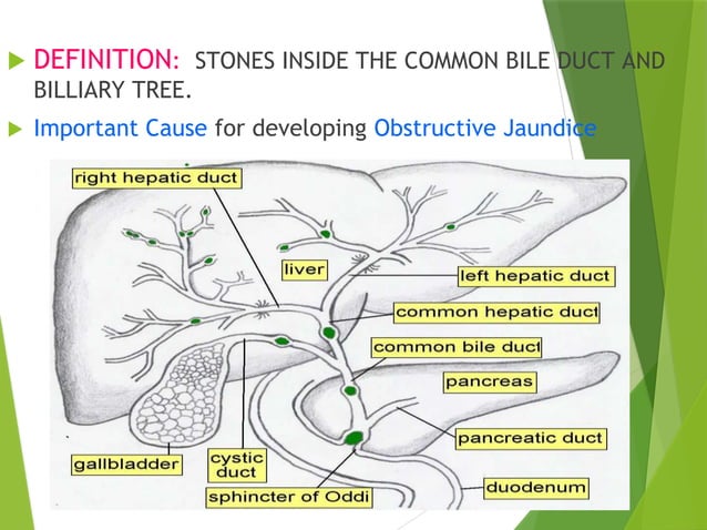 choledocholithiasis-170601193413.pdf