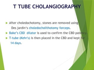 choledocholithiasis-170601193413.pdf