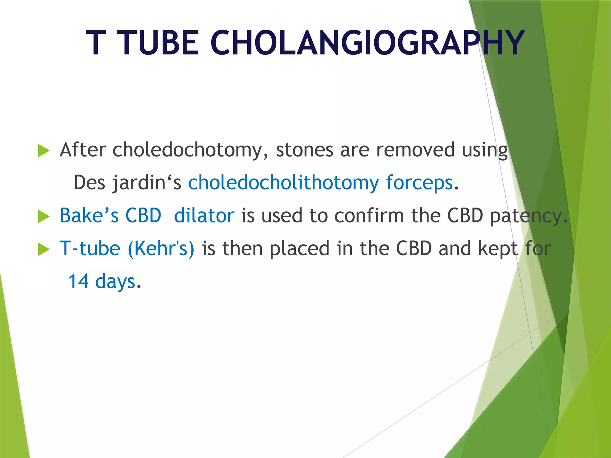 Choledocholithiasis...one step ahead | PPTX
