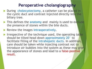 Choledocholithiasis...one step ahead | PPTX