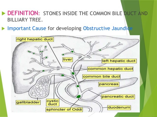 Choledocholithiasis...one step ahead