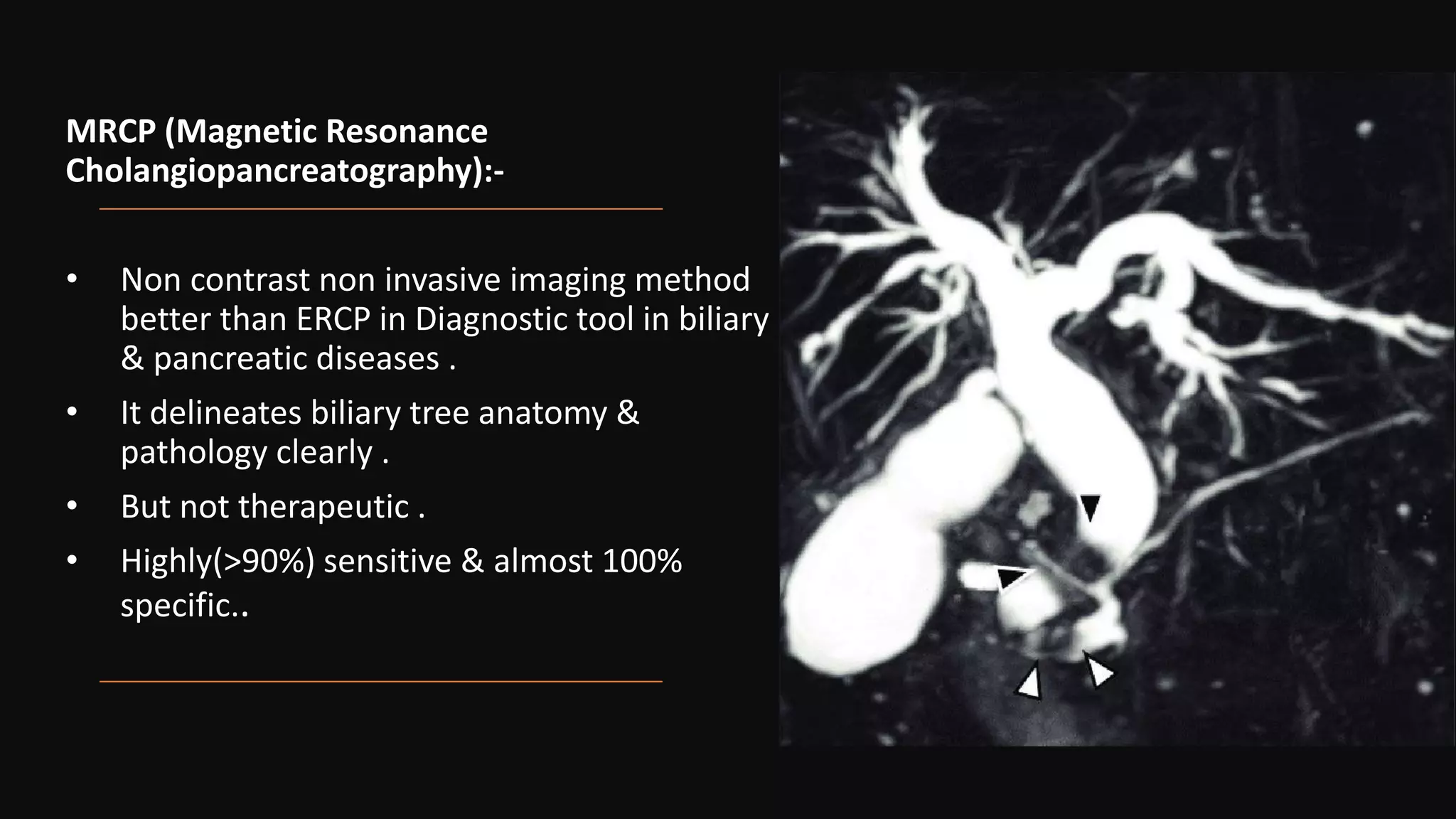 CHOLEDOCHOLITHIASIS.pptx