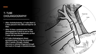 CHOLEDOCHOLITHIASIS.pptx