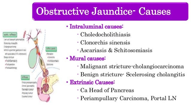 Choledocholithiasis- obstructive jaundice