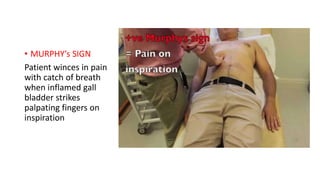 Cholelithiasis | PPTX