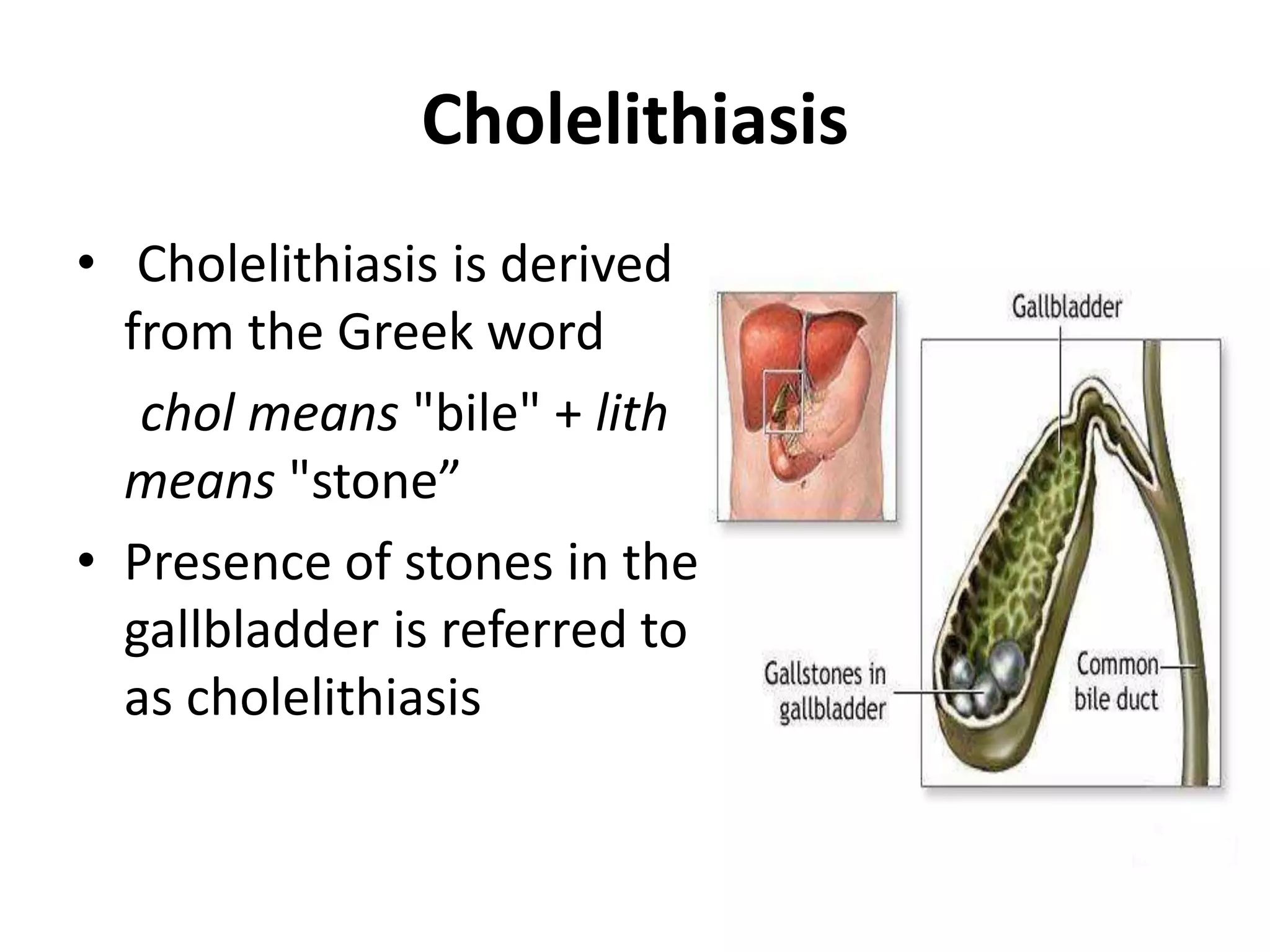 Cholelithiasis disease of GIT | PPTX