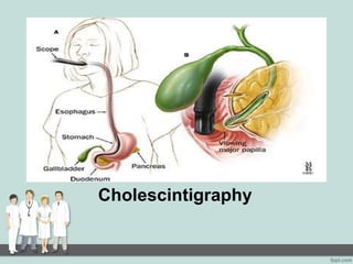 Cholelithiasis | PPTX