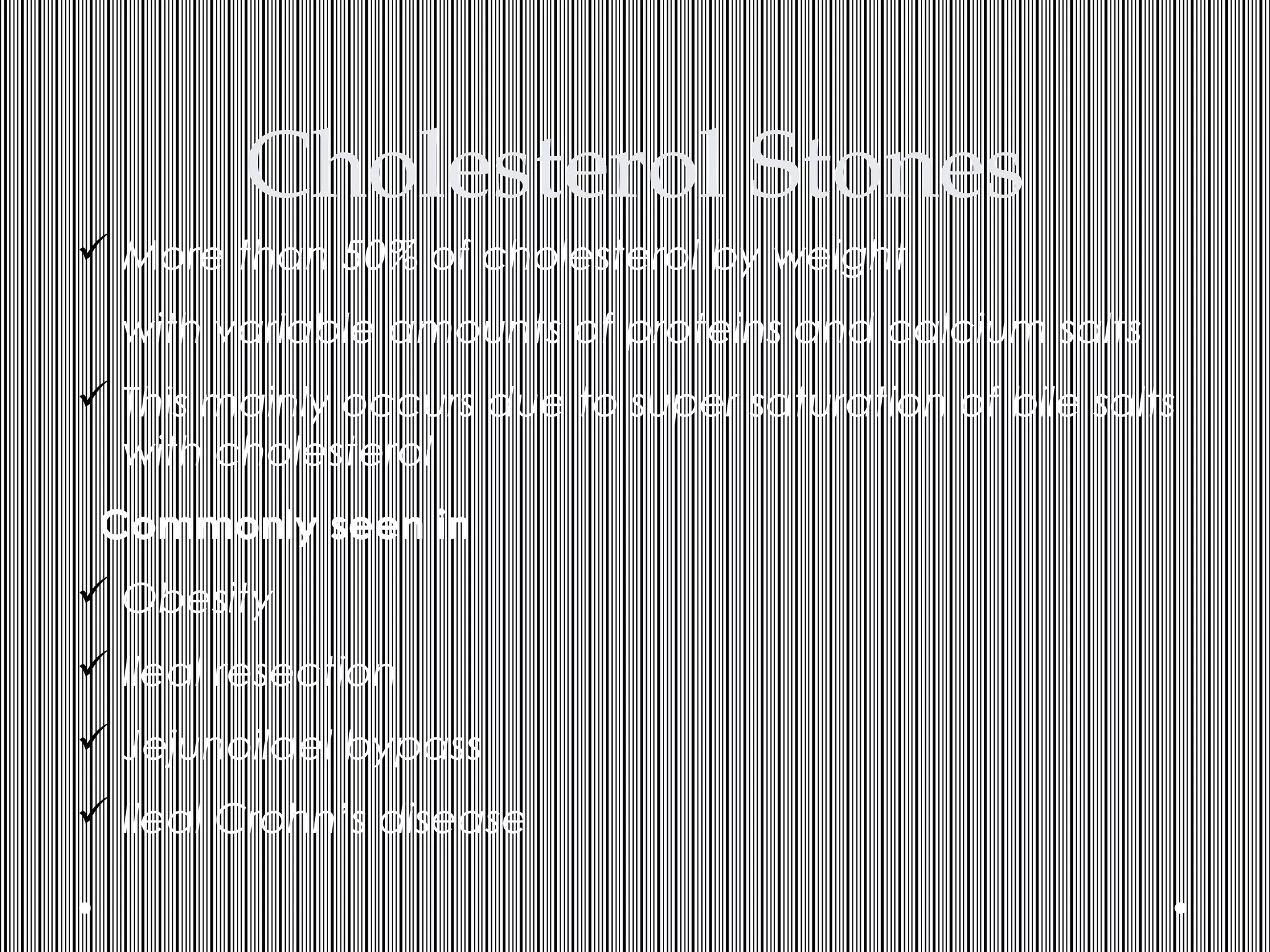 Cholelithiasis | PPT