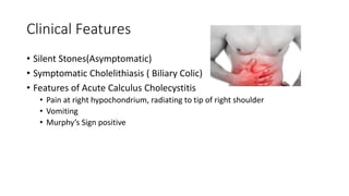 Cholelithiasis at a glance- 1 | PPT