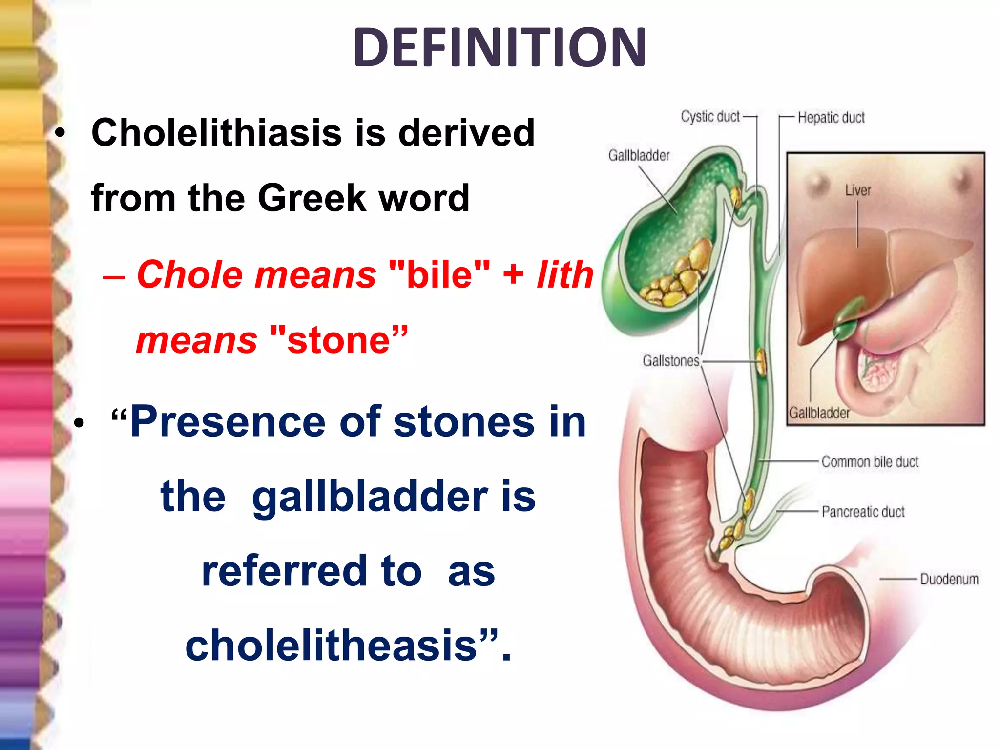 CHOLELITHIASIS | PPTX