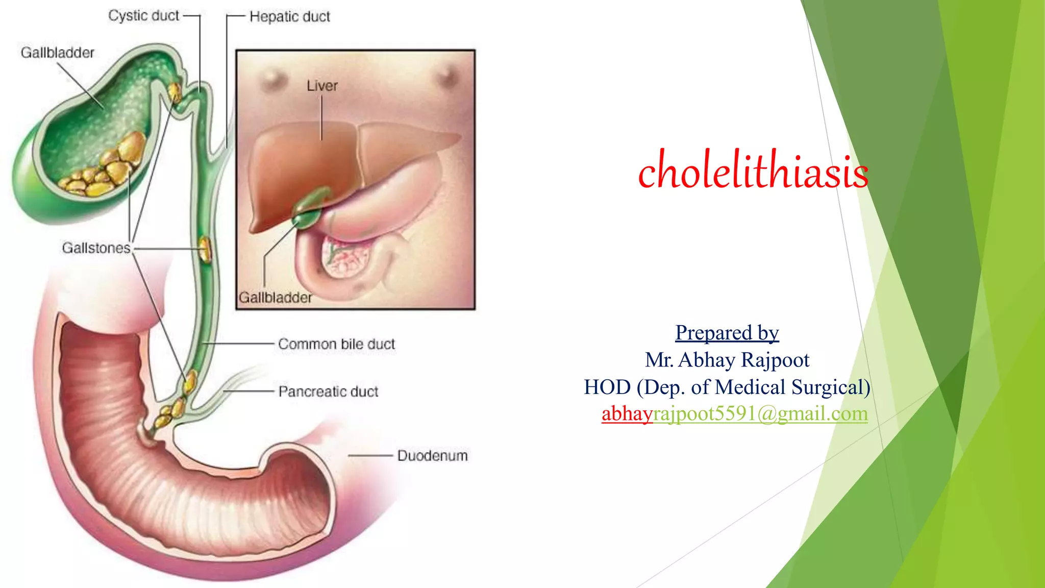 Cholelithiasis & Cholecystitis | PPTX
