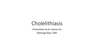 Cholelithiasis | PPT