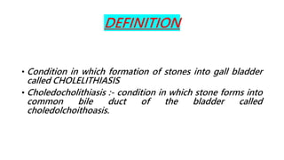 cholelithiasis | PPTX
