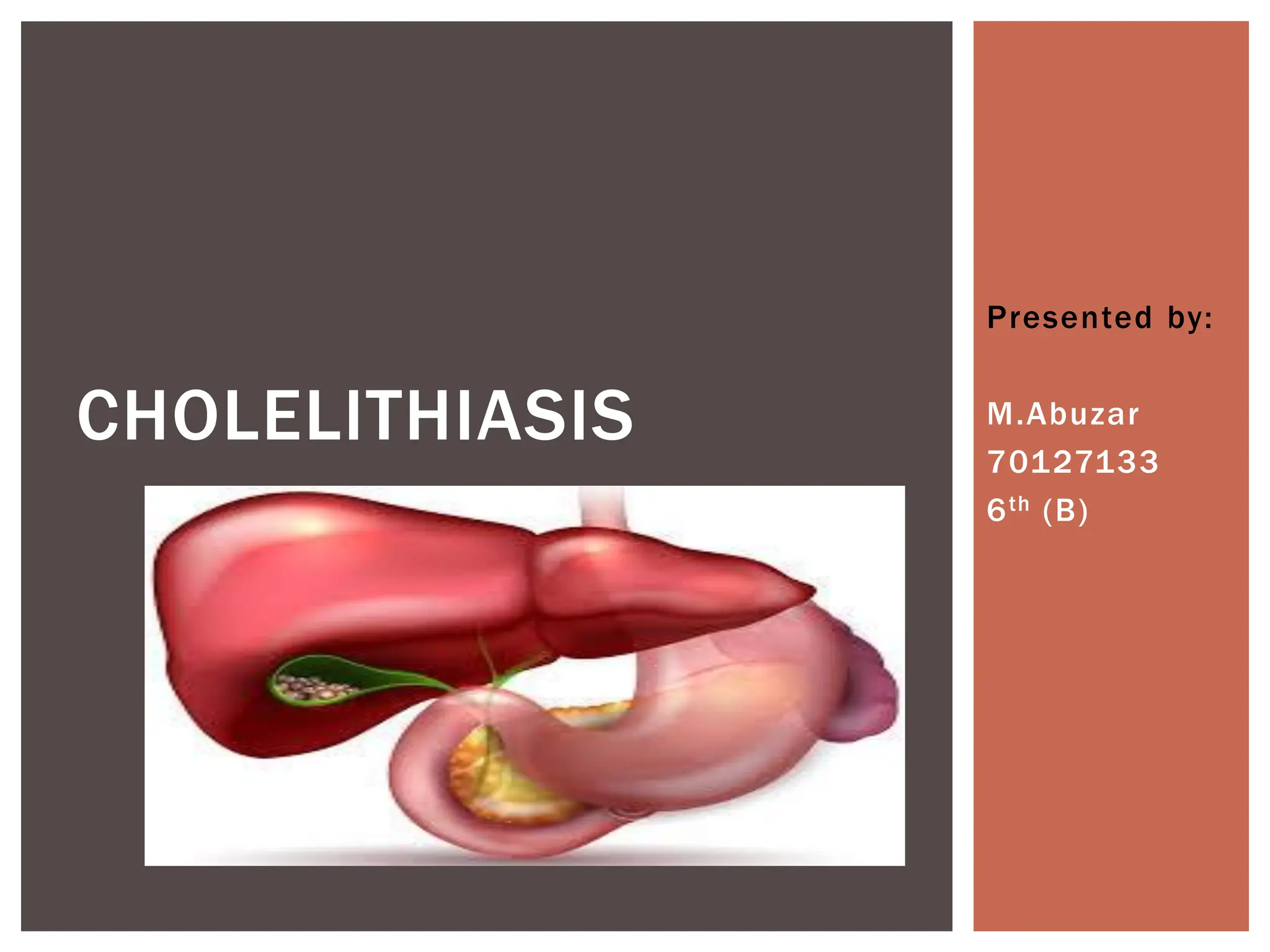 cholelithiasis power point presentation1 | PDF