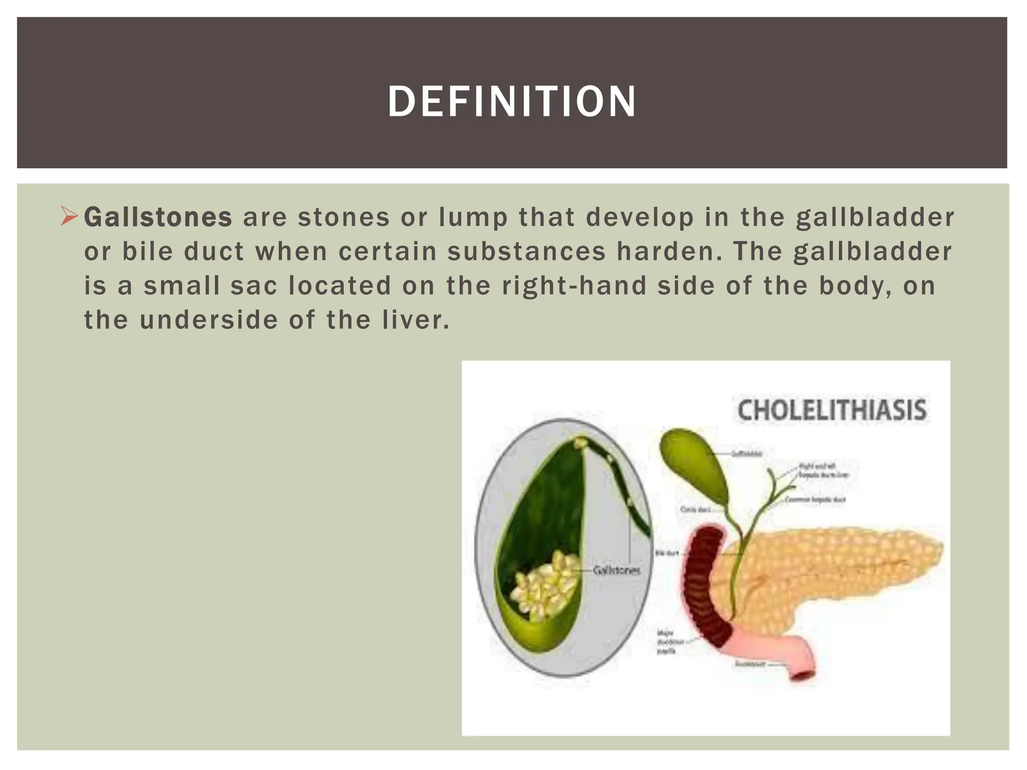 cholelithiasis power point presentation1 | PDF