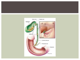 cholelithiasis power point presentation1 | PDF