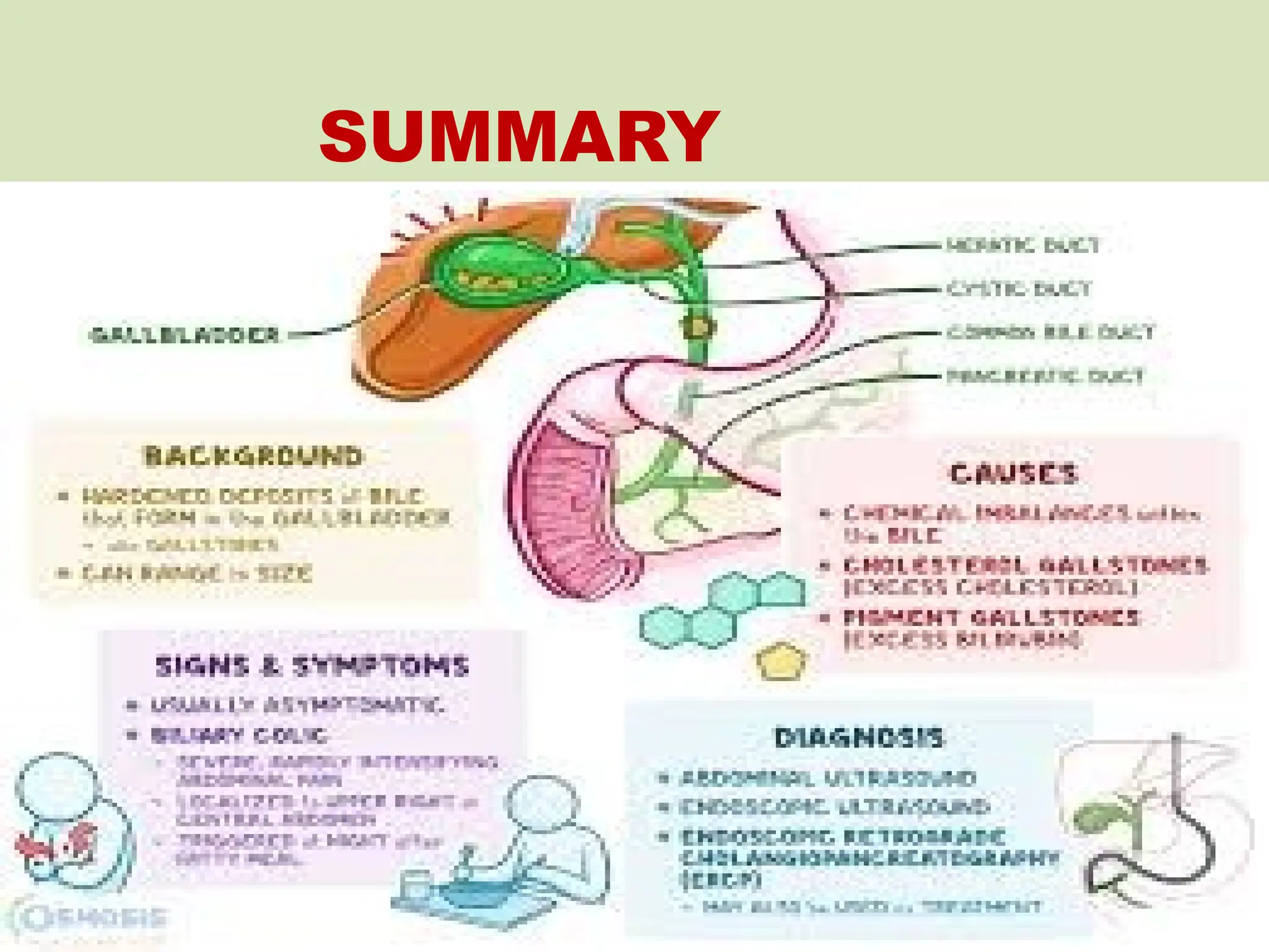 CHOLELITHIASIS (gall bladder stone).pptx
