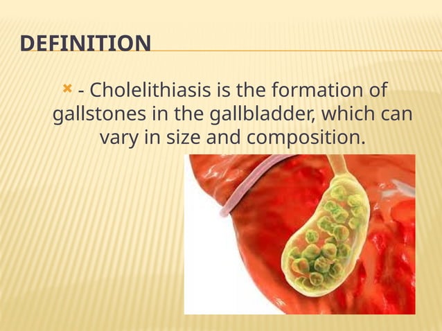 cholelithiasis. Clinical features. Treatment | PPT