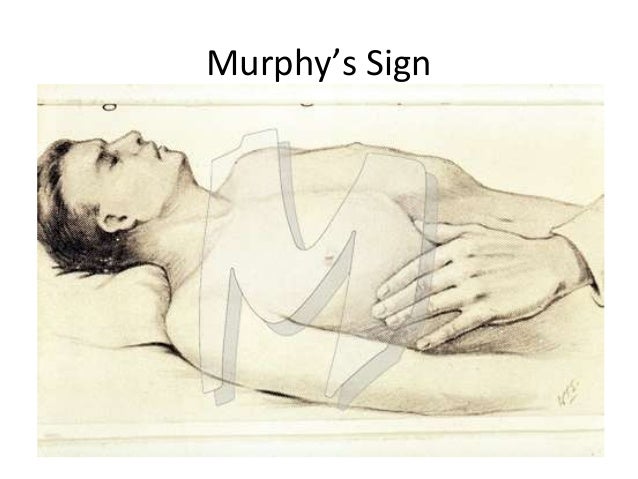 Cholelithiasis final year mbbs lecture