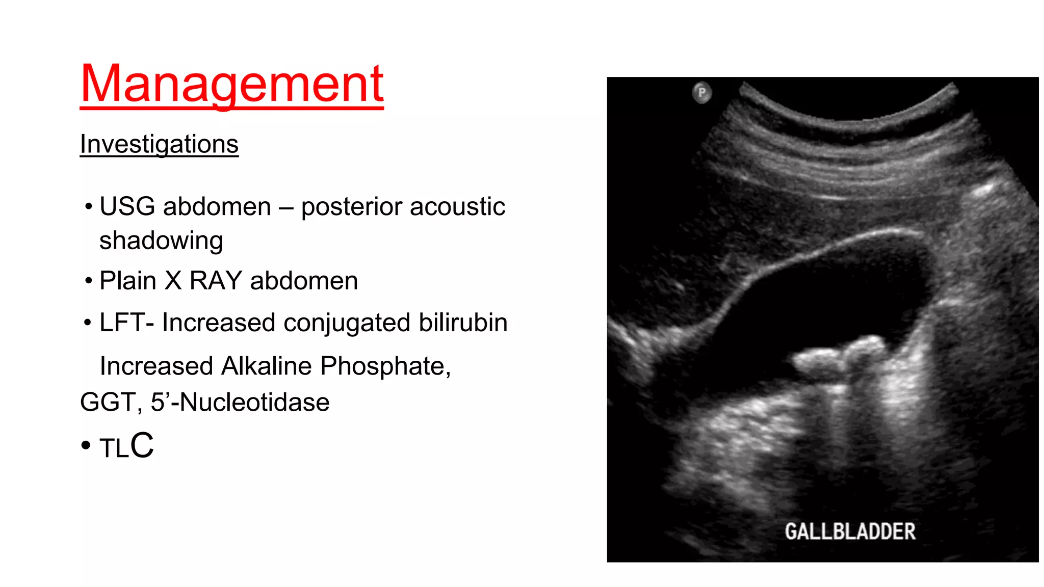 cholelithiasis-lecture.pptx