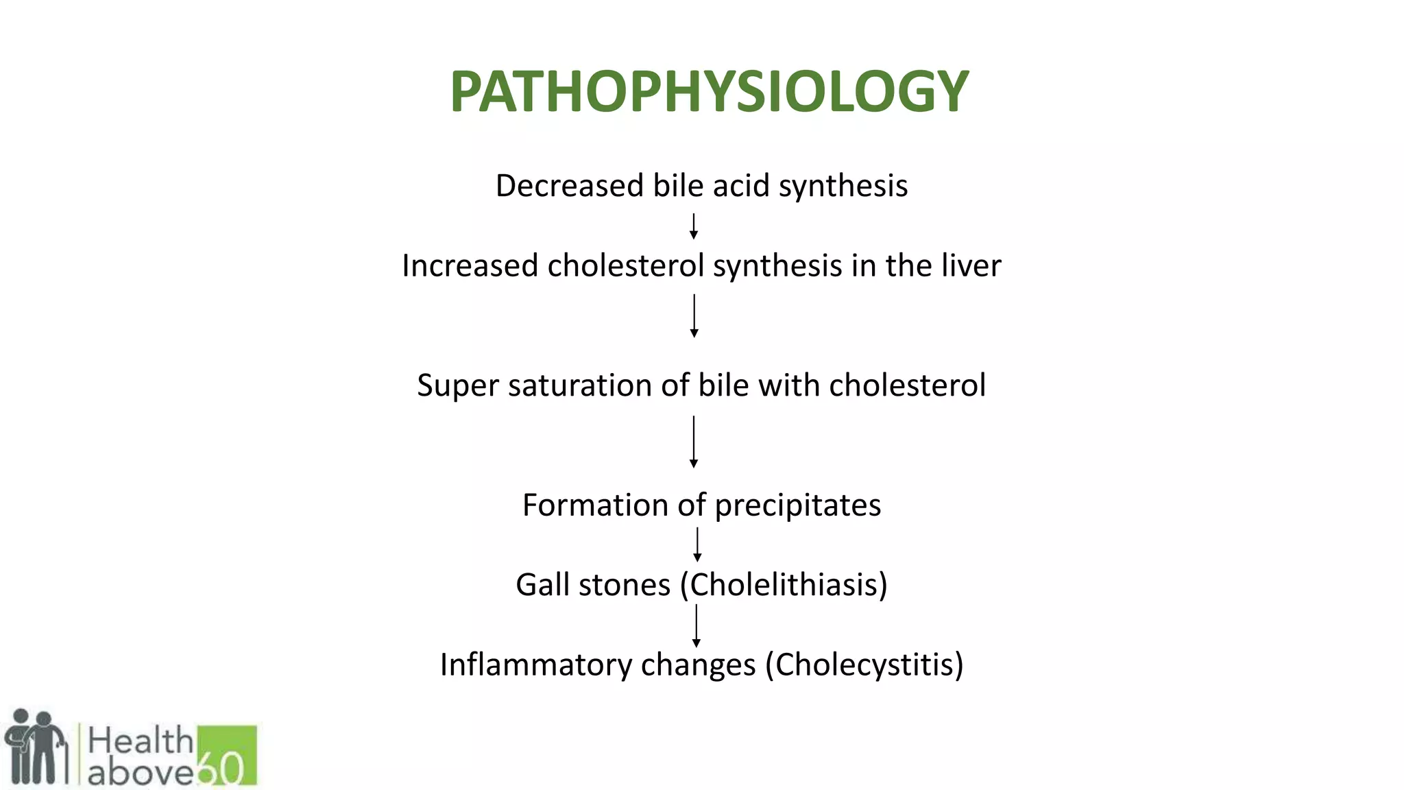 Anatomy of Cholelithiasis | PPTX