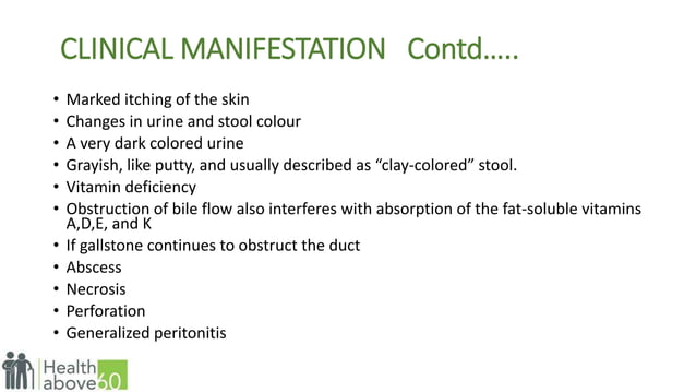 Anatomy of Cholelithiasis | PPTX