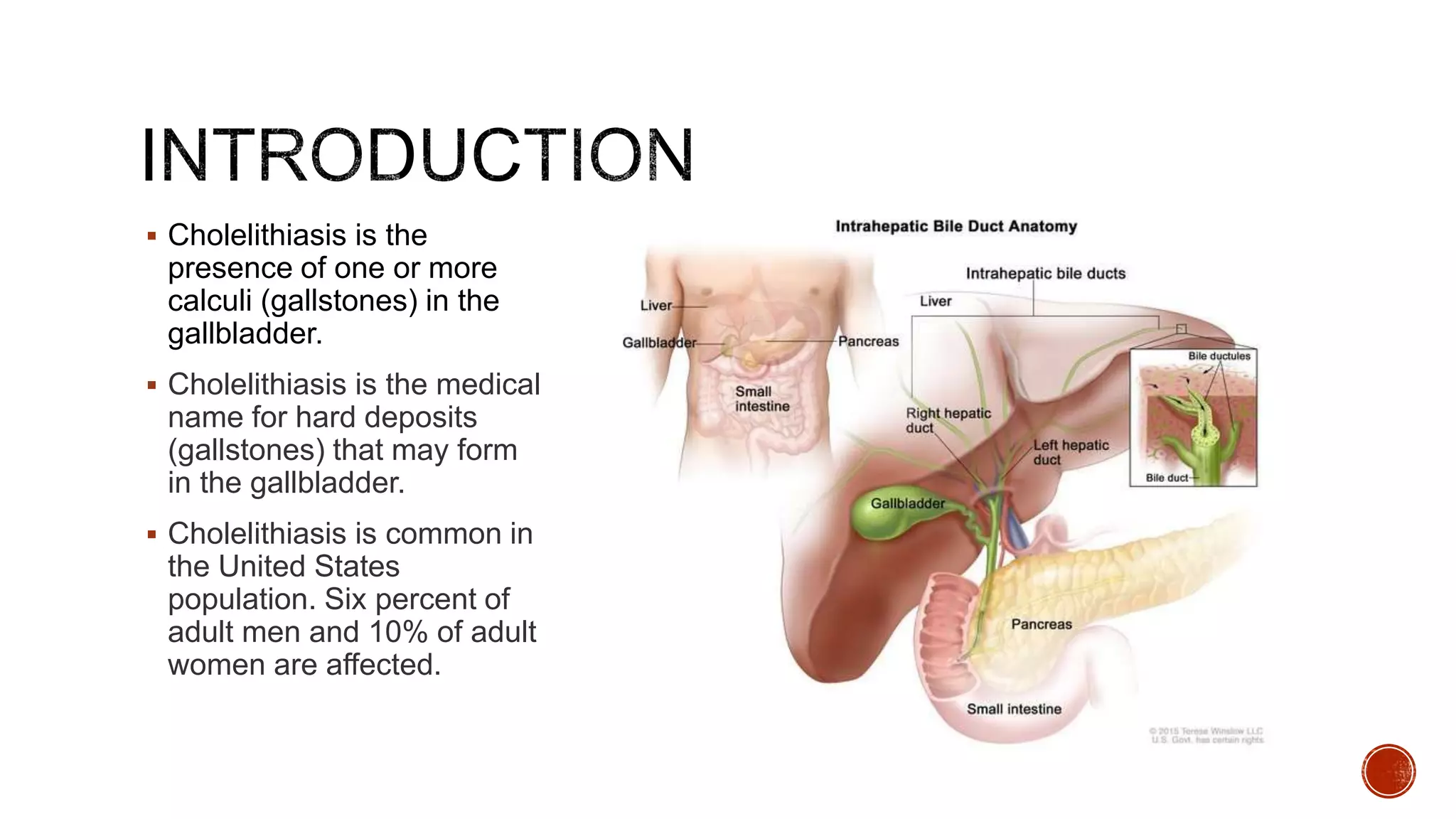 Cholelithiasis ( gallstones) | PPTX