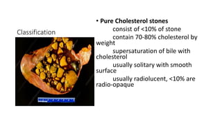 Cholelithiasis and Cholecystitis.pptx