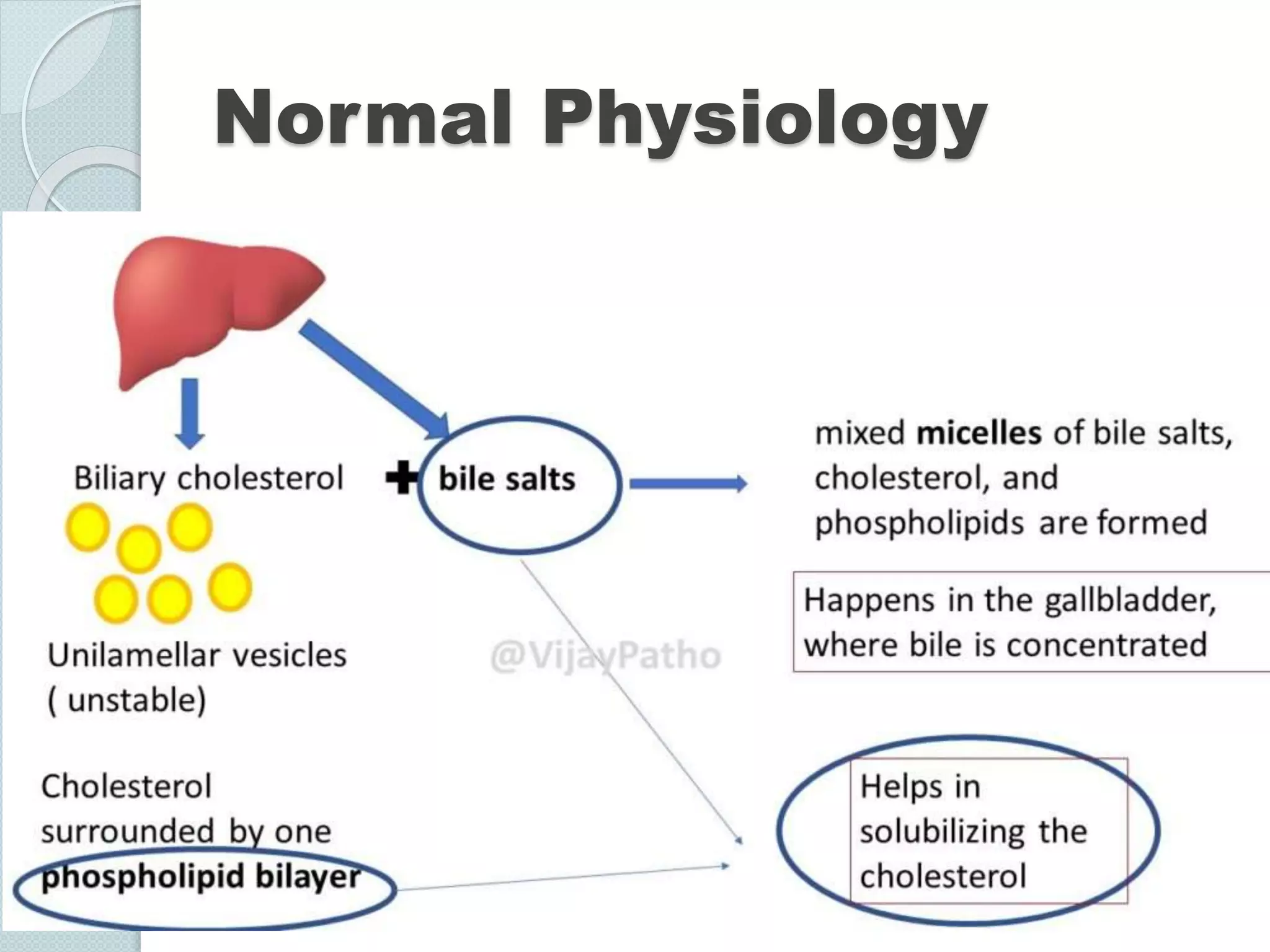 Cholelithiasis and cholecystitis, sunita kharel | PPT