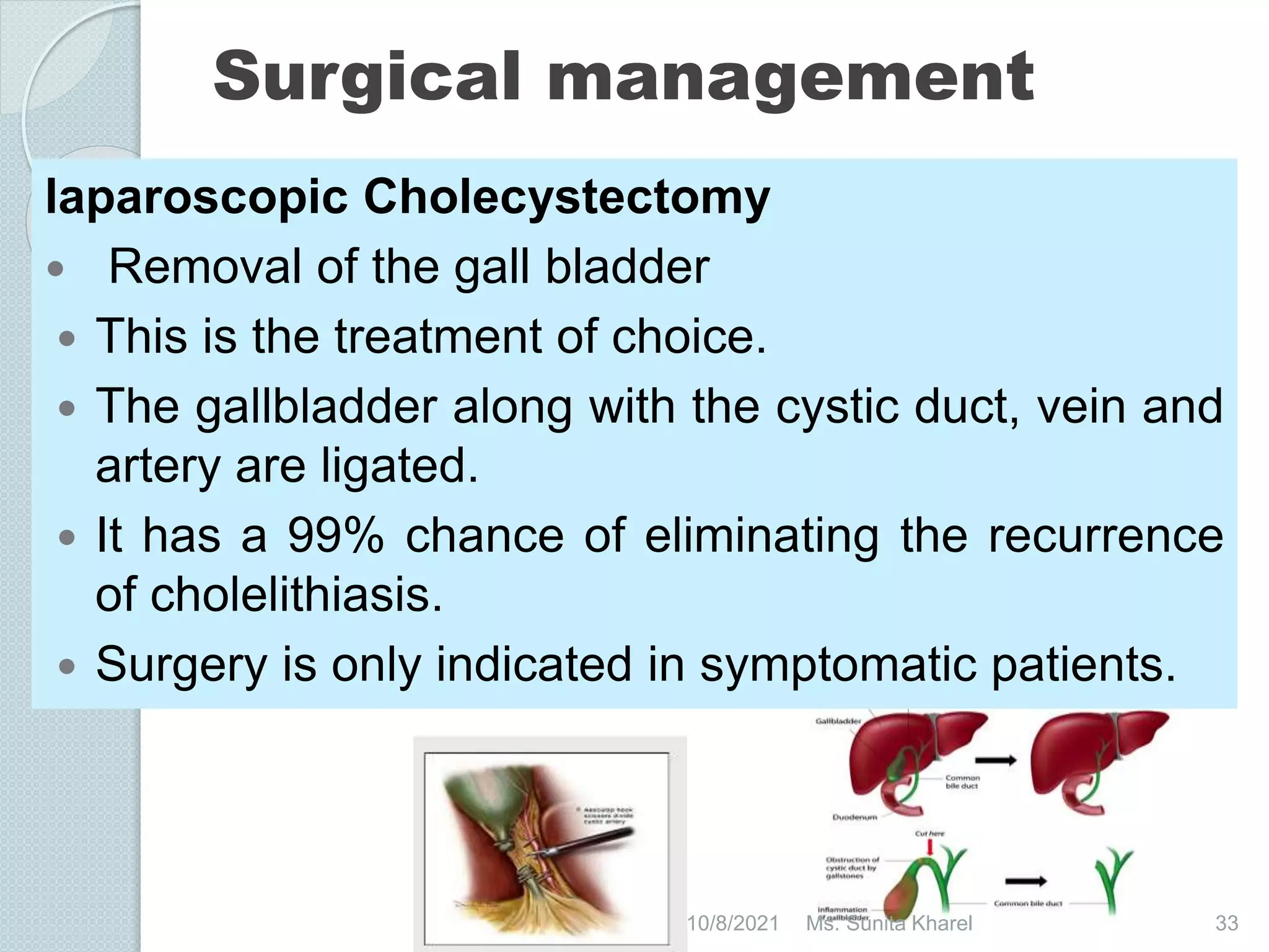 Cholelithiasis and cholecystitis, sunita kharel | PPT