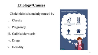 cholelithiasis, by Baqir Naqvi.pptx
