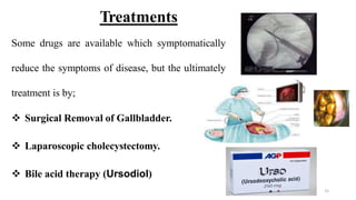 cholelithiasis, by Baqir Naqvi.pptx