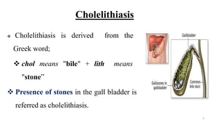 cholelithiasis, by Baqir Naqvi.pptx